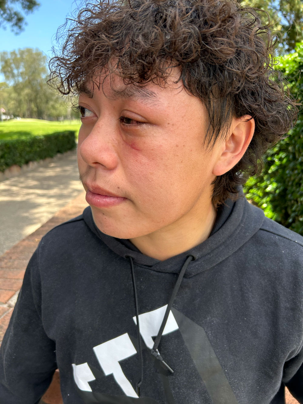 'ALL I CAN SEE IS BLACK': Jeffrey Guan details long journey ahead in ...